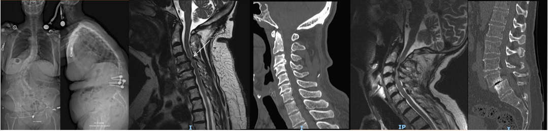 Joshua Li, M.D., Ph.D. - University of Virginia School of Medicine